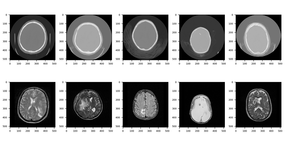 The Affine model with MI is not satisfying for CT/MR co-registration · Issue #164 · voxelmorph ...