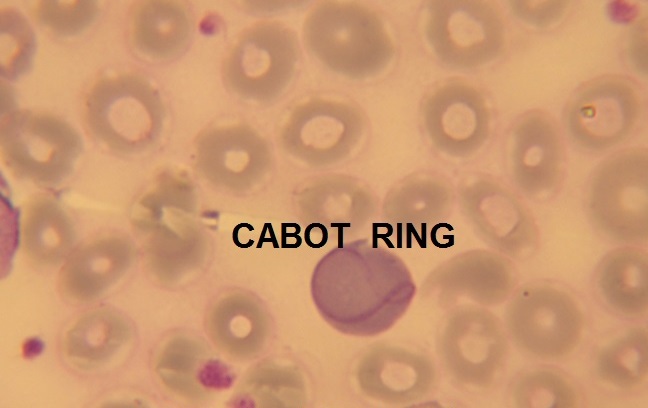 هماتولوژی دانشگاه علوم پزشکی ایلام | هفته سوم اردیبهشت ۱۳۹۵