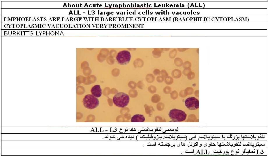 هماتولوژی دانشگاه علوم پزشکی ایلام | هفته سوم اردیبهشت ۱۳۹۵